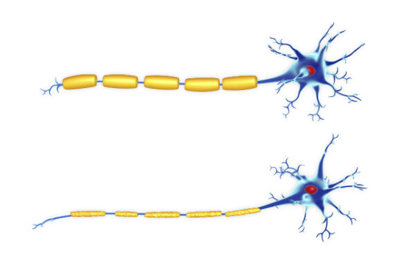 Promising Treatment For Devastating Brain Disease Can Cause Cancer ...