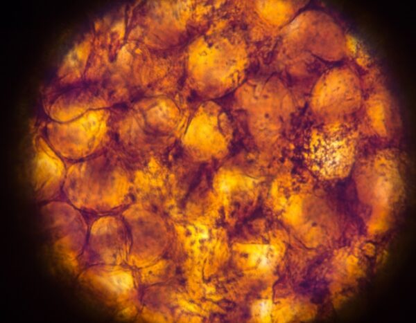 Fat Cells Seem to Cling to The Memory of Being Obese, Study Finds ...