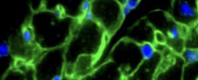 Drugs Like Ozempic May Have a Shrinking Effect on The Heart : ScienceAlert