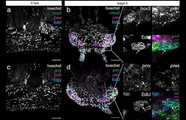This Worm Can Regrow Its Body by Reversing to a Stem Cell-Like State ...