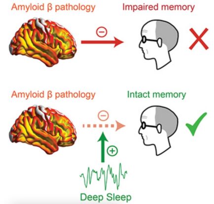 There's a Critical Thing We Can All Do to Keep Alzheimer's Symptoms at ...