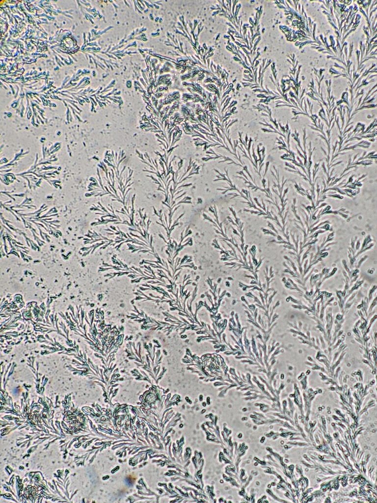 Microscope Mysteries: Answers