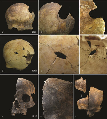 Bronze Age British Ate Their Enemies According to Gruesome Discovery ...