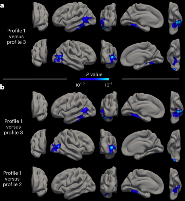 Your Psychological Profile May Hint at Your Risk of Cognitive Decline ...