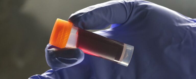 World's First Blood Test For Endometriosis Step Closer Following Trial ...