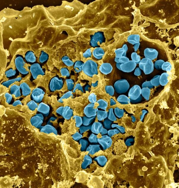 Rabbit Fever In Humans Has Surged In The Last Decade Cdc Reports Sciencealert