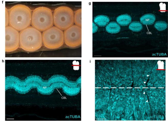 Octopus Arms Are Controlled by a Nervous System That's Like No Other ...