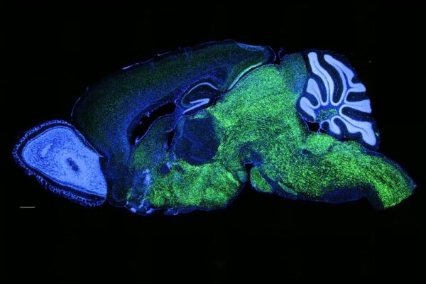 Scientists Put a Human Language Gene Into Mice And Changed Their Voice ...