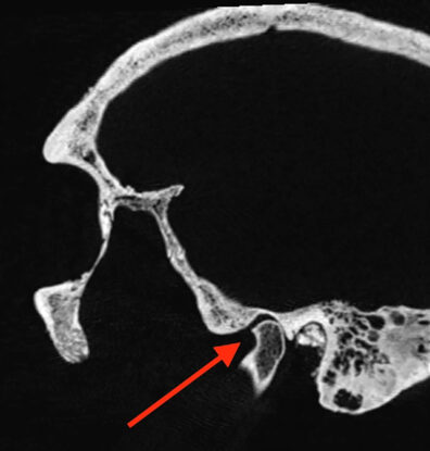 X-Rays of Viking-Age Skulls Reveal a Shocking Level of Disease ...