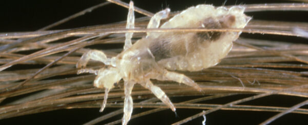 Head Lice Are Digging In, But There's a Simple Way to Get Rid of Them ...