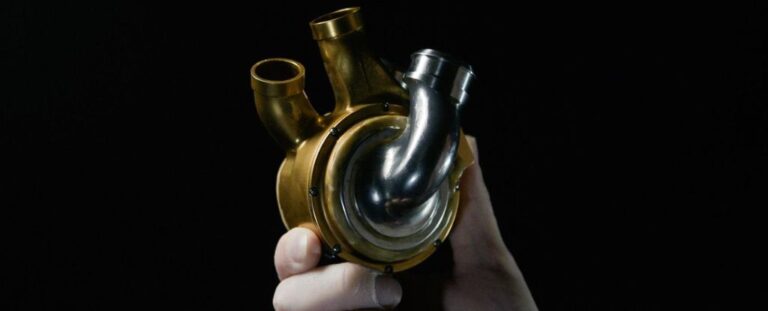 World First: Man Leaves Hospital With Life-Saving Titanium Heart ...