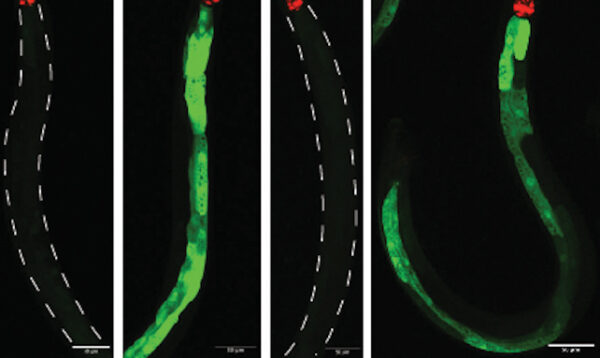 One Brain Receptor Explains Why 'Virgin' Male Worms Take More Risks ...