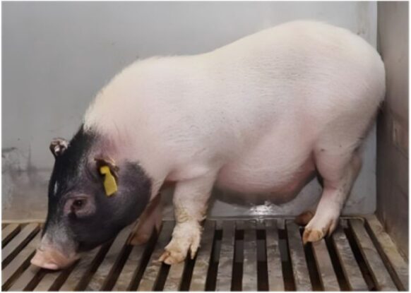 Pig Liver Successfully Transplanted Into Human Patient in World First ...