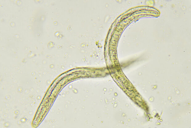Humans Can Host a Variety of Parasitic Worms. Here's How to Spot The ...