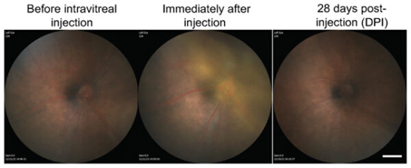 Gold Injections in The Eye May Be The Future of Vision Preservation ...