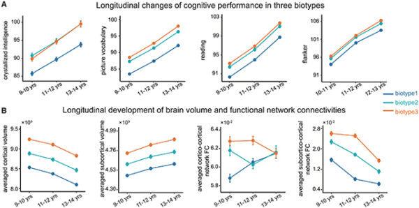 Just 15 Extra Minutes of Sleep Is Linked to Brain Benefits in Young ...