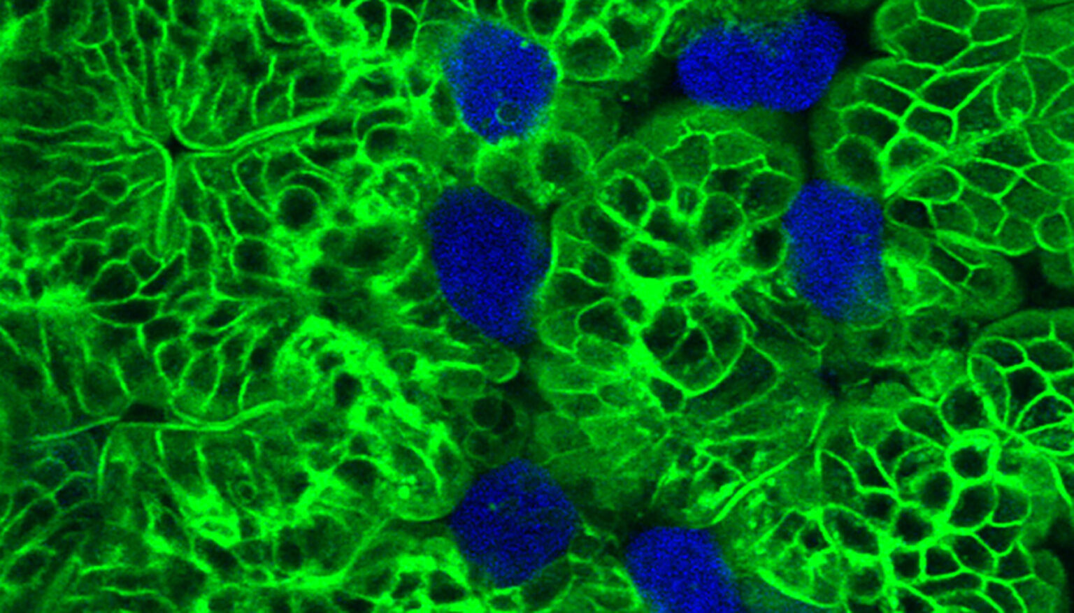 Common Parasite Rips The Face From Your Cells to Wear as a Disguise ...