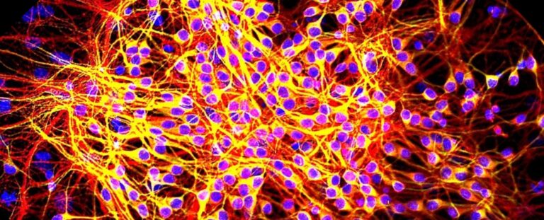 FDA-Approved Sleeping Pill Slows Alzheimer's Tangles in Pre-Clinical ...