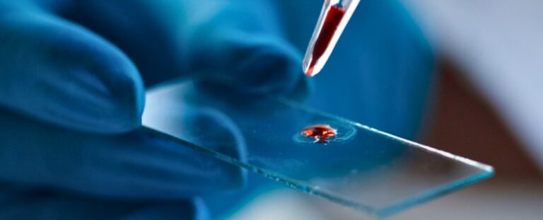 How a Medical Mystery Revealed The World's Rarest Blood Type : ScienceAlert