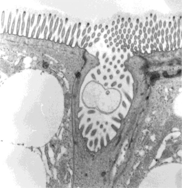 New Cell Discovered in Pythons Allows Them to Completely Digest Bones ...