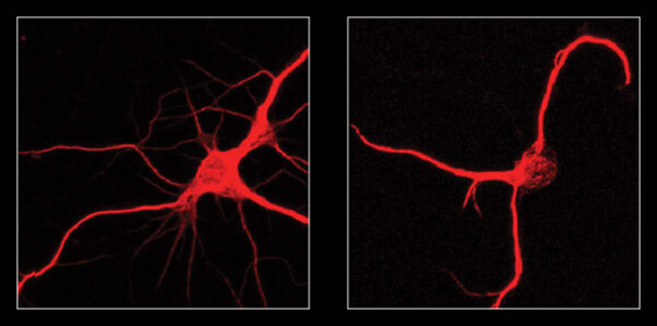 Switching Off One Crucial Protein Appears to Reverse Brain Aging in ...