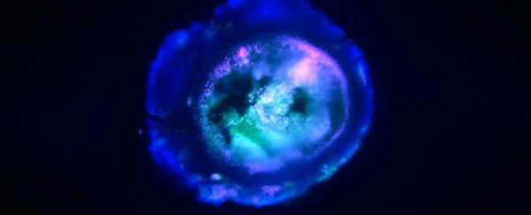 This Amazing Blob Is Stunningly Similar to The Human Brain : ScienceAlert