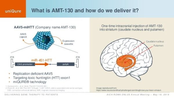 Breakthrough Gene Therapy Slows Huntington's Disease by 75% : ScienceAlert