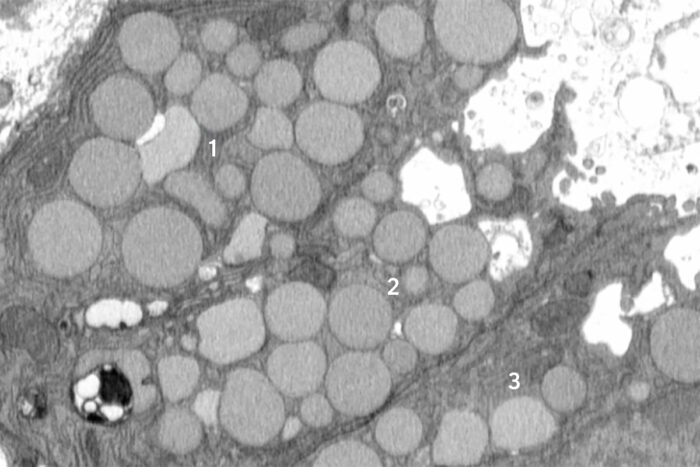 Injured Cells Can 'Vomit' Waste to Boost Healing, Study Finds ...
