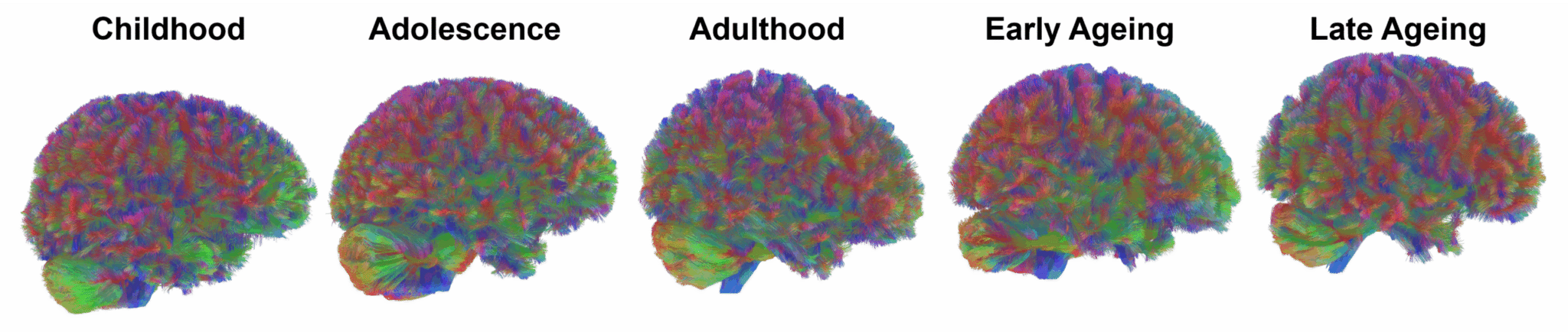 Your Brain Goes Through 5 Distinct Epochs, Massive Study Finds ...