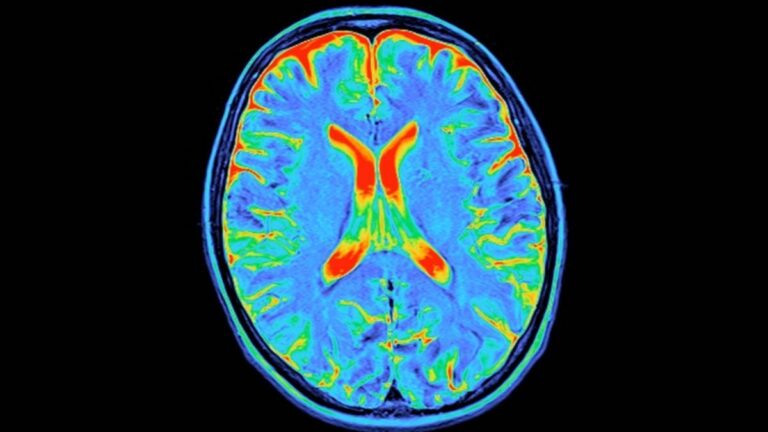 Your Brain Goes Through 5 Distinct Epochs, Massive Study Finds ...