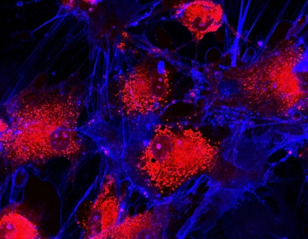 'Menstrual Masking' Is Going Viral, But Is It Really That Good For Your ...