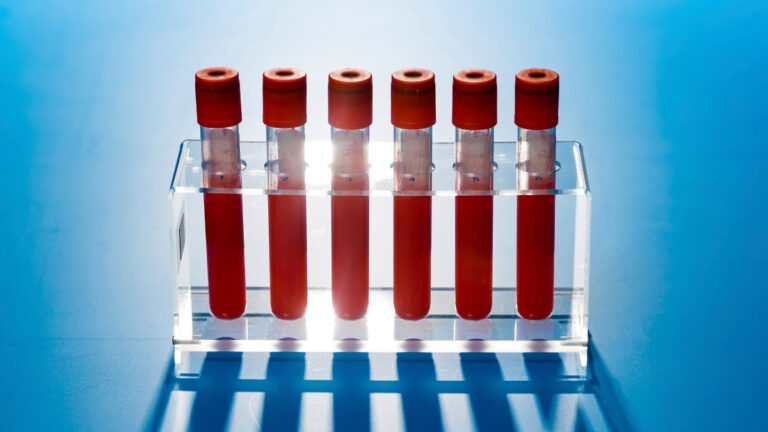'Exciting' New Cancer Blood Test Results Hide a Concerning Problem ...