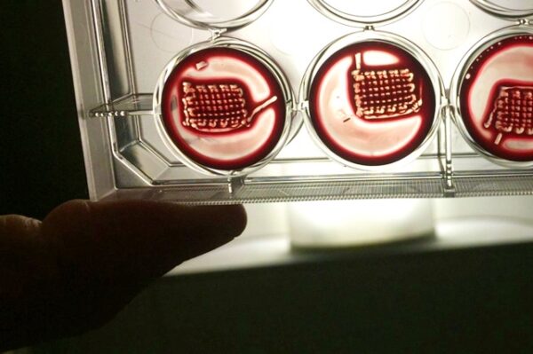 Breakthrough to Strengthen Bones Could Reverse Osteoporosis : ScienceAlert