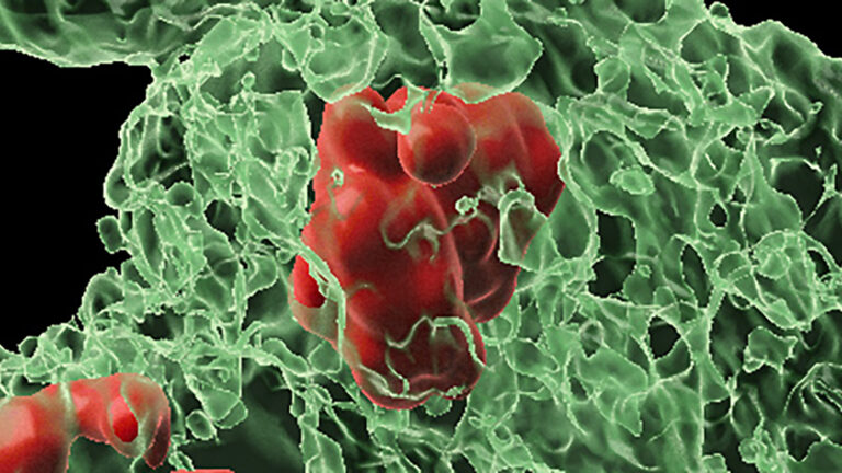 Body Resurrects Cells Marked For Death, Solving a 50-Year Mystery ...