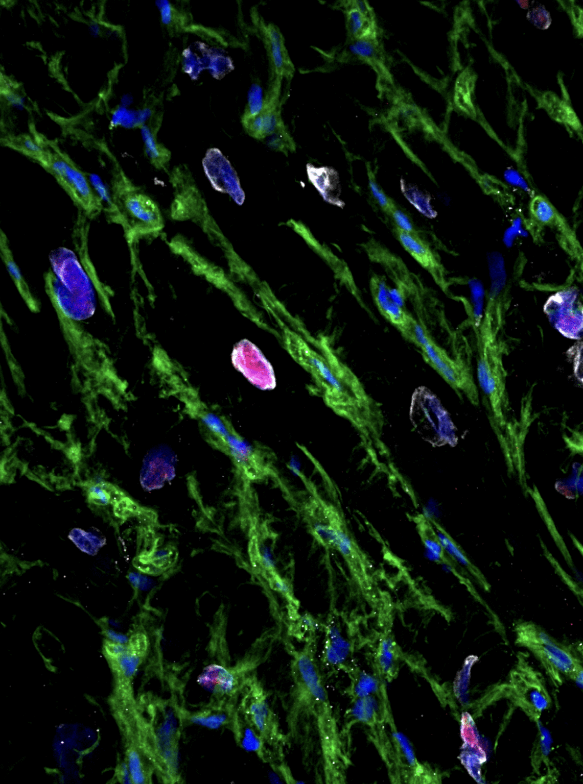 Human Heart Tissue Actually Can Regenerate After a Heart Attack, New ...