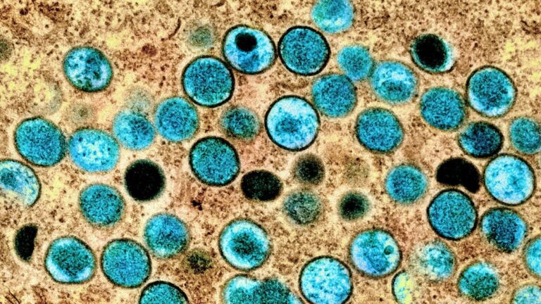 Old Foe Tops Expert's List of Viruses to Watch in 2026 : ScienceAlert