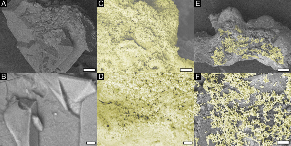 Bacteria Play Previously Unknown Role in Kidney Stones, Study Finds ...
