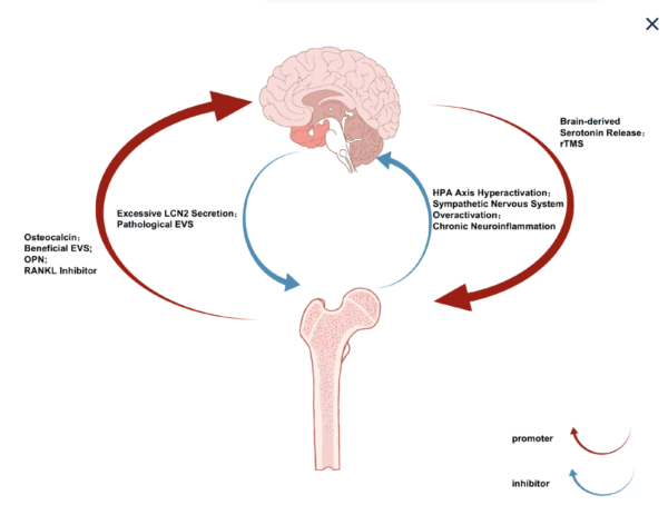 'Brain-Bone Axis' May Link Depression With Osteoporosis, Study Claims ...