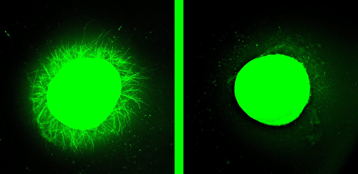 Scientists Grew Mini Human Spinal Cords, Then Made Them Repair After ...