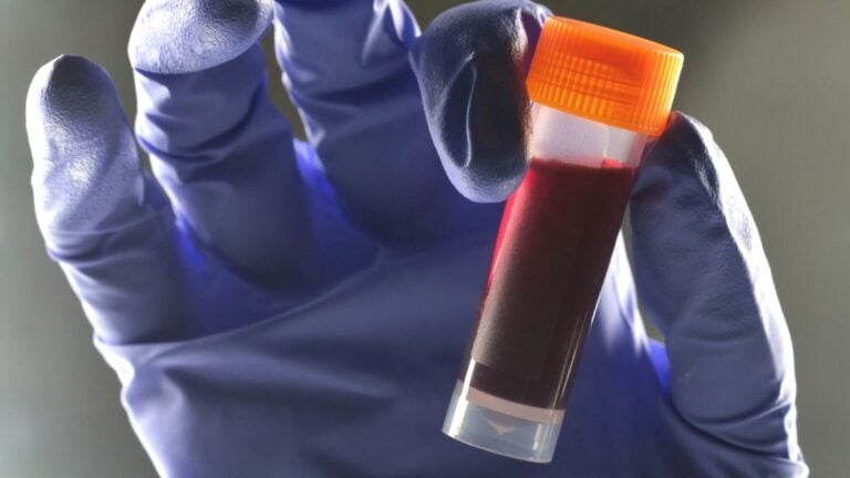 One Blood Type Appears to Carry Higher Risk of Type 2 Diabetes ...