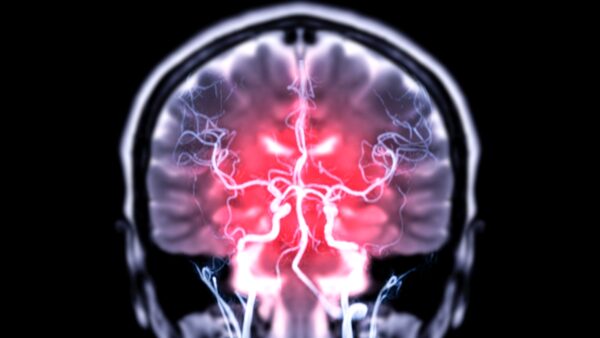 One Brain Chemical May Be Key to Breaking a Habit, Study Finds ...