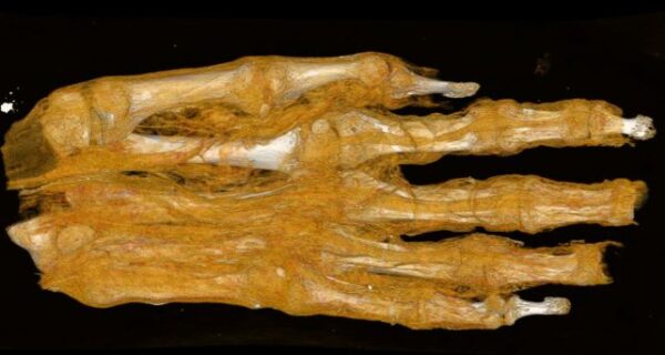 Medical Scans Reveal Hidden Secrets Inside Ancient Egyptian Mummies ...