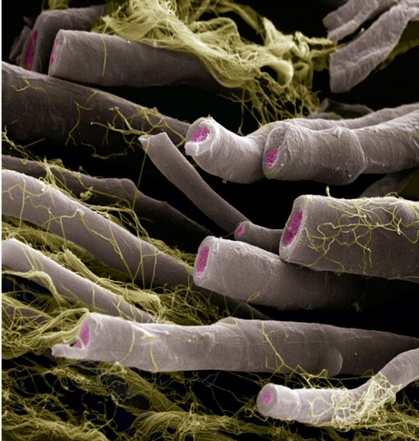 Experimental Brain 'Pacemakers' May Rewire Circuits Linked to ...