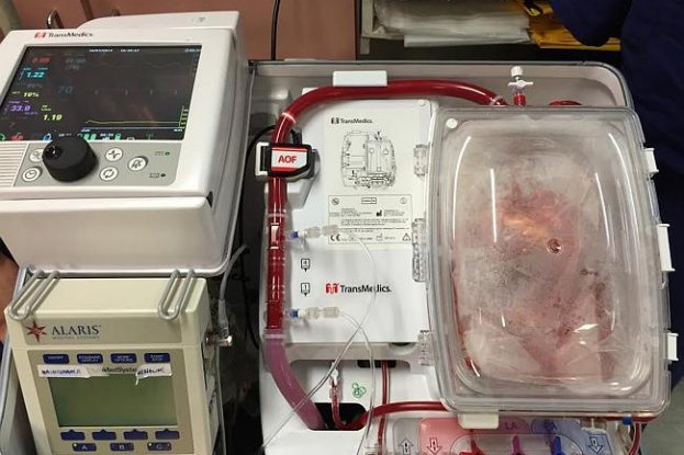 World First: "Dead Heart" Successfully Transplanted at Australian ...