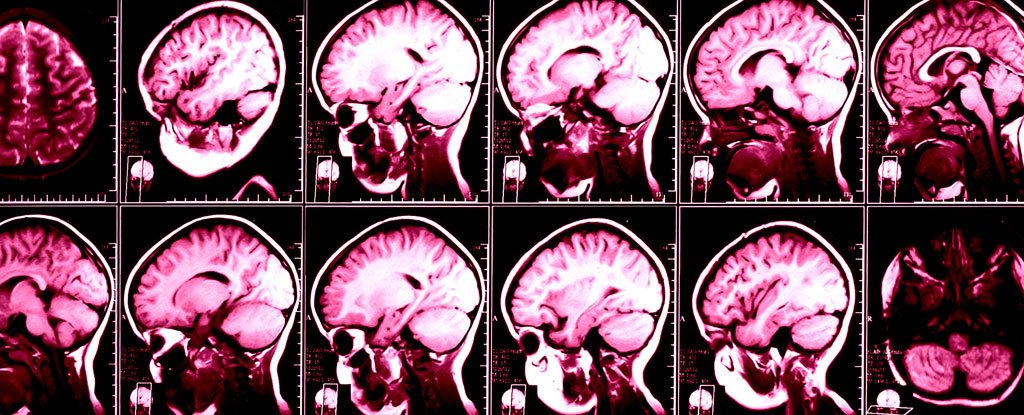 Everybody Has a Distinct 'Memory Style' That Affects How We Recall ...