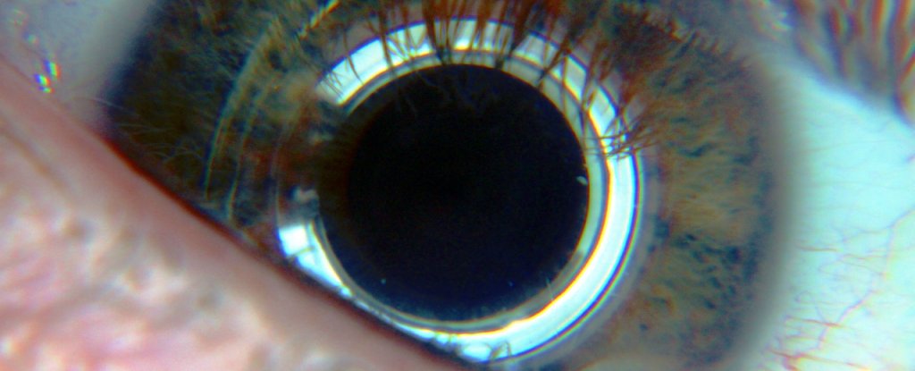 Humans Will Be Cyborgs Within 200 Years, Expert Predicts : ScienceAlert