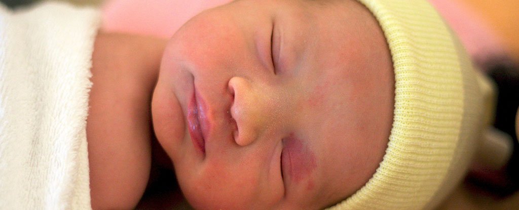 Babies Born by Caesarean Section Are More Likely to Be Obese, Study ...