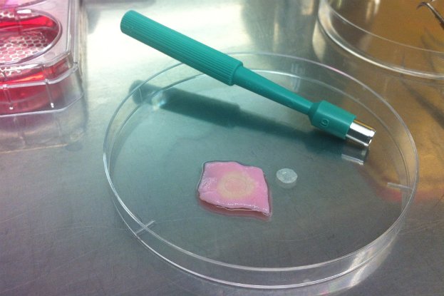 Scientists Are Using Artificial Skin to Find Better Bandages For Burn ...