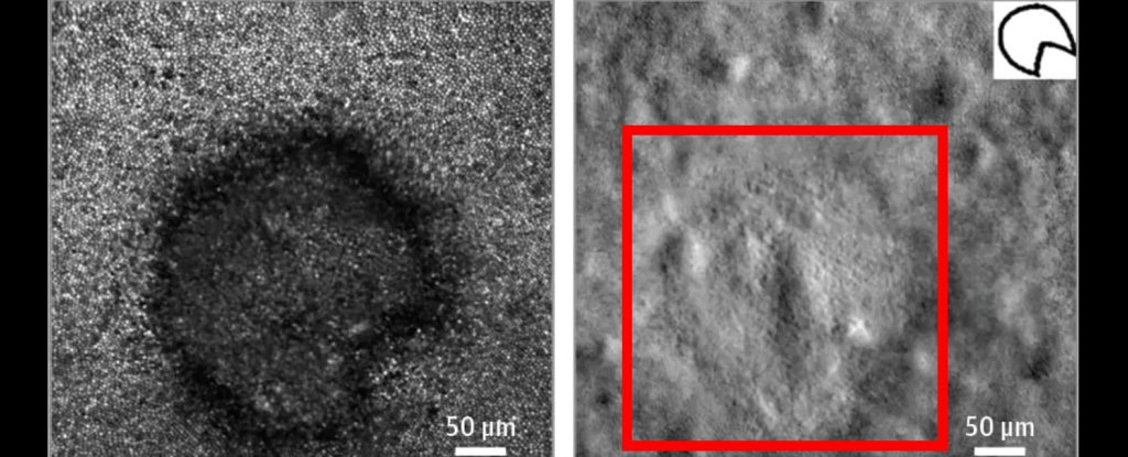 The Solar Eclipse Burned an Image of Itself Onto a Woman's Retina ...