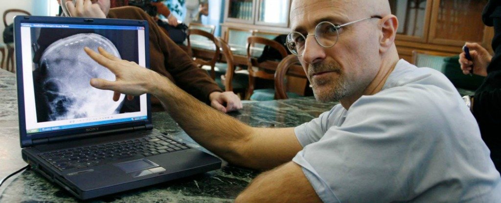 5 Obstacles We Need to Overcome Before Head Transplants Can Become a ...